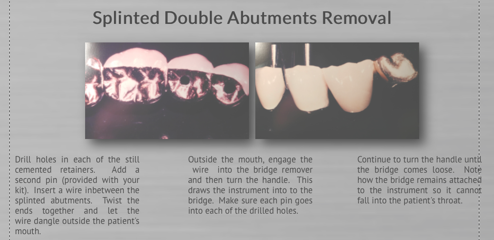 Case Studies – The Higa Bridge Remover